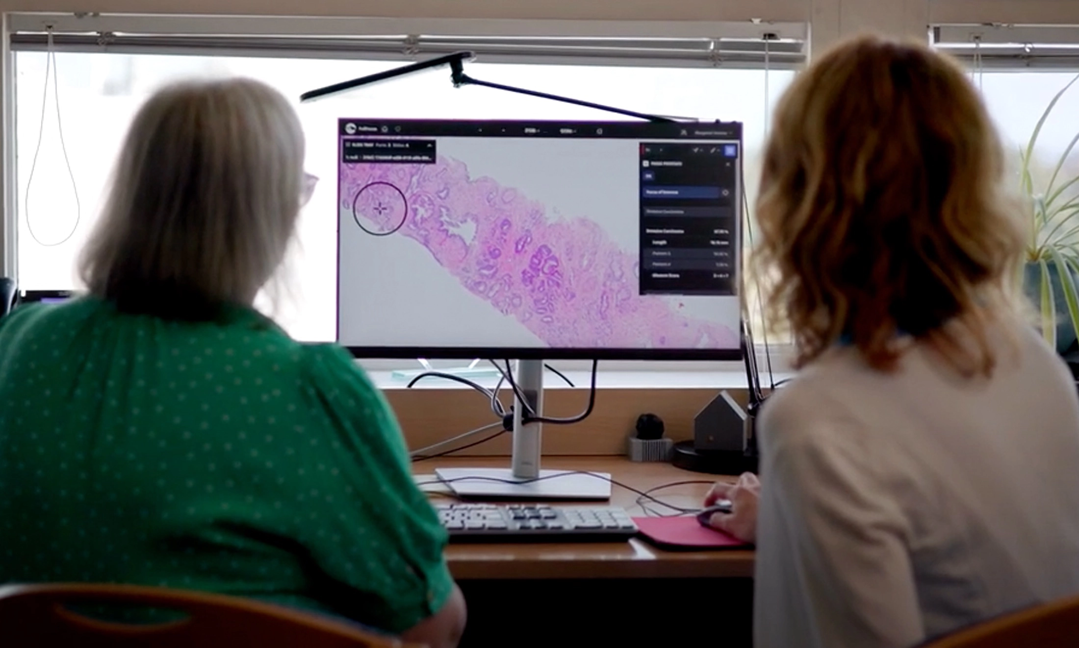 Uk Trials Ai For Prostate Cancer Detection Automation Tools Ai